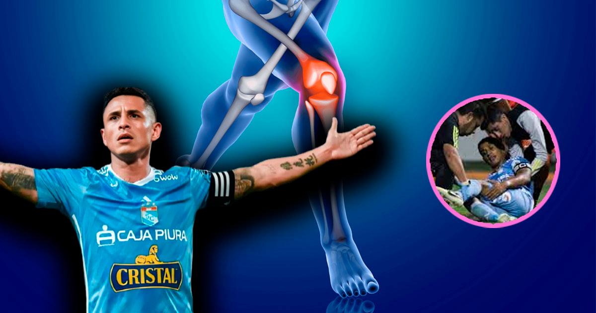 ¿Qué es la rotura de ligamentos cruzados y cómo se recupera? La dura lesión que alejó a Yoshimar ...